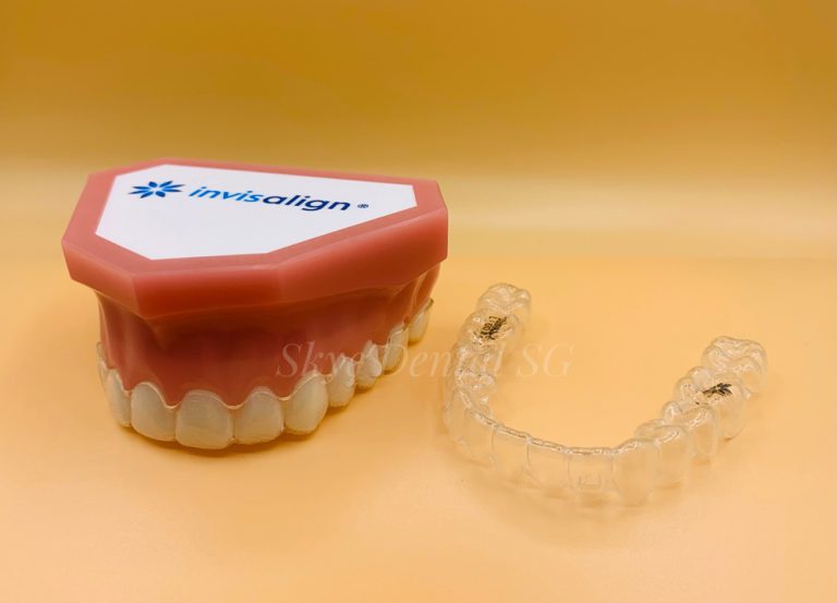 Chew-ie Your Way To Invisalign Success! | Skye Dental